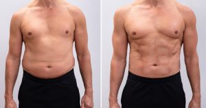 ECA Stack Guide - Ephedrine, Caffeine, and Aspirin | Evolve