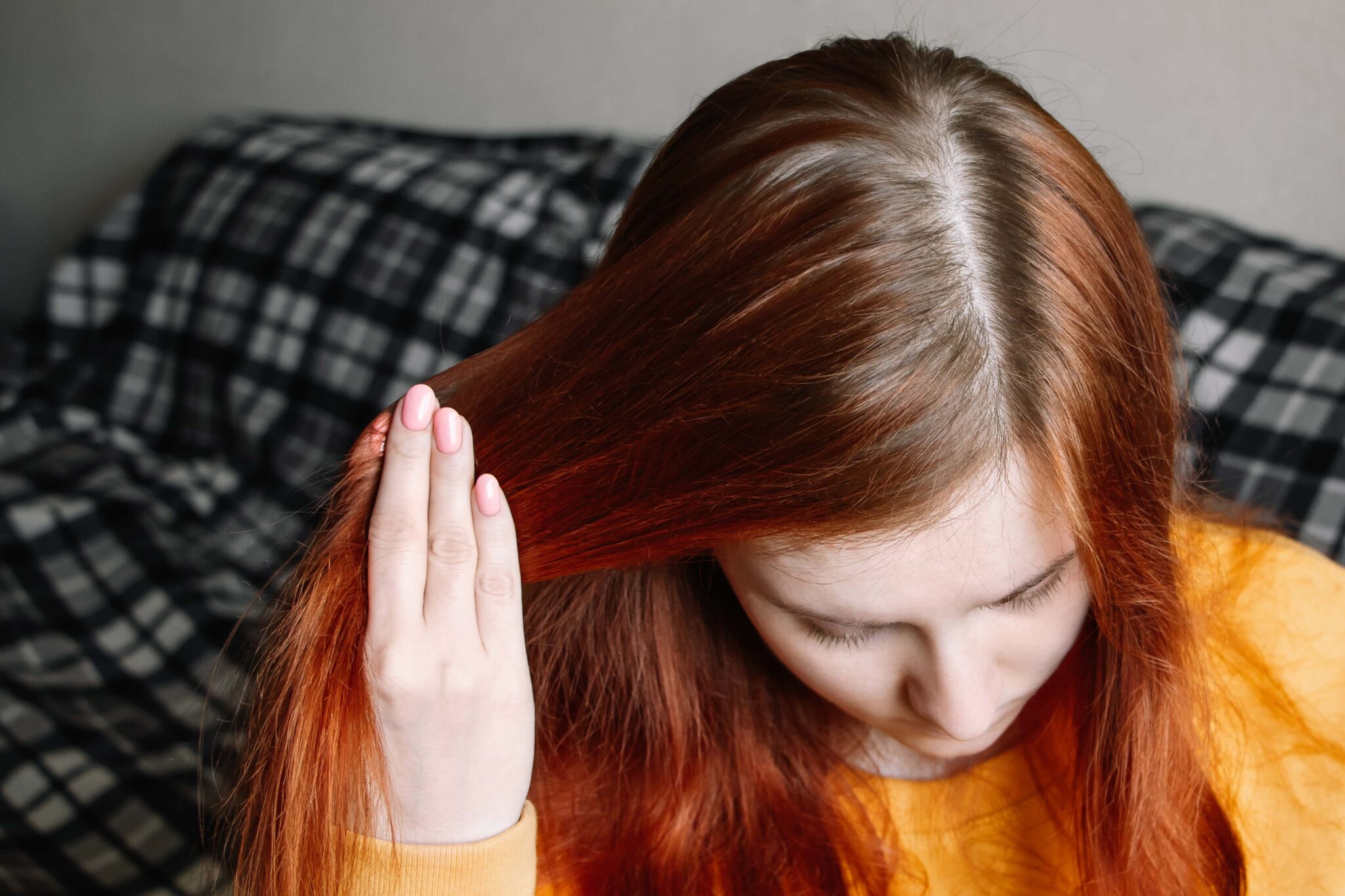 How to Deal with a Receding Hairline for Women | Evolve