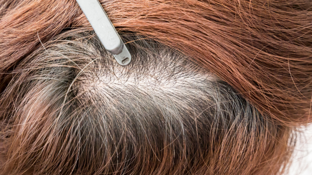 Itchiness During Menopause: Causes and Relief | Evolve